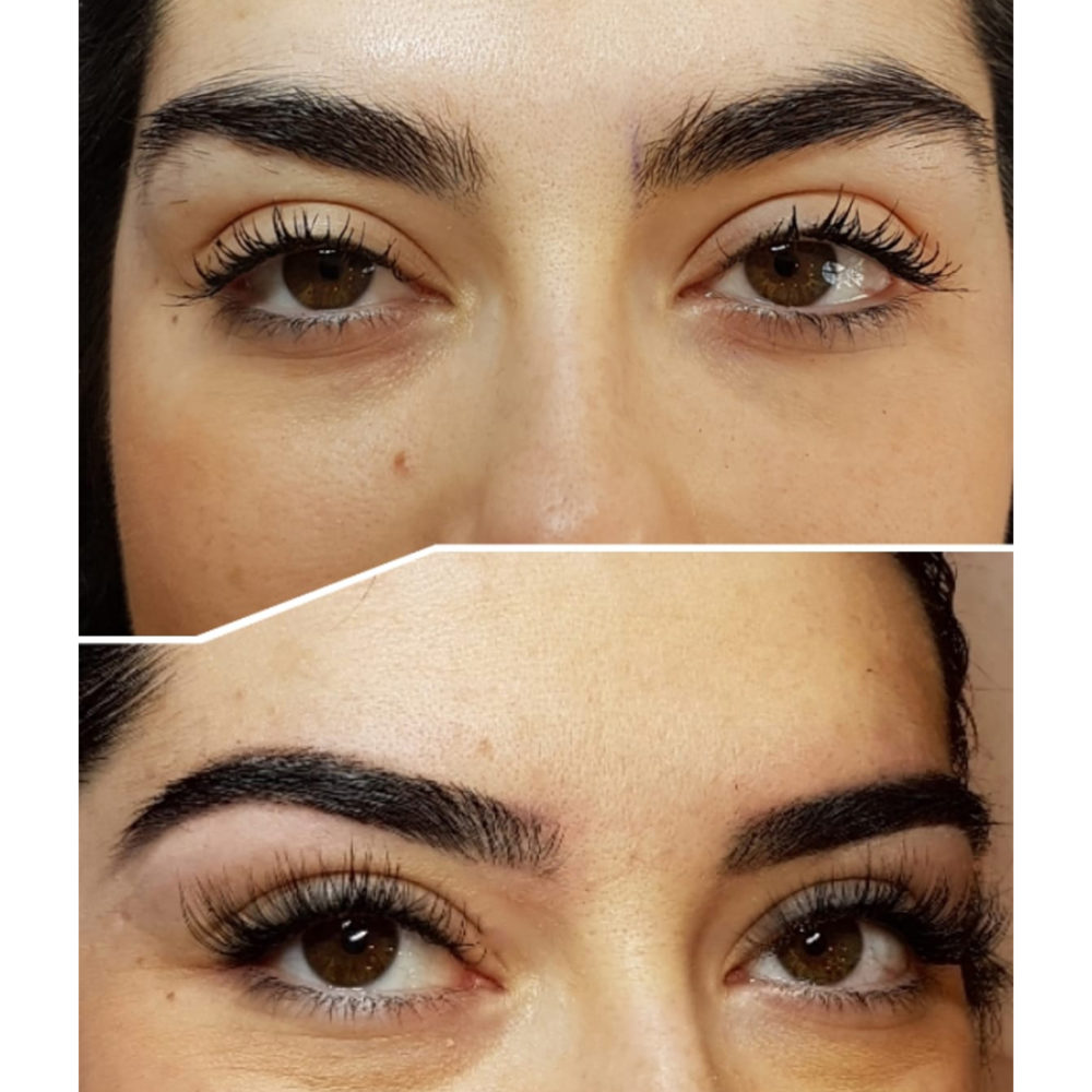 EXTENSIONS - REPERE DU SOURCIL